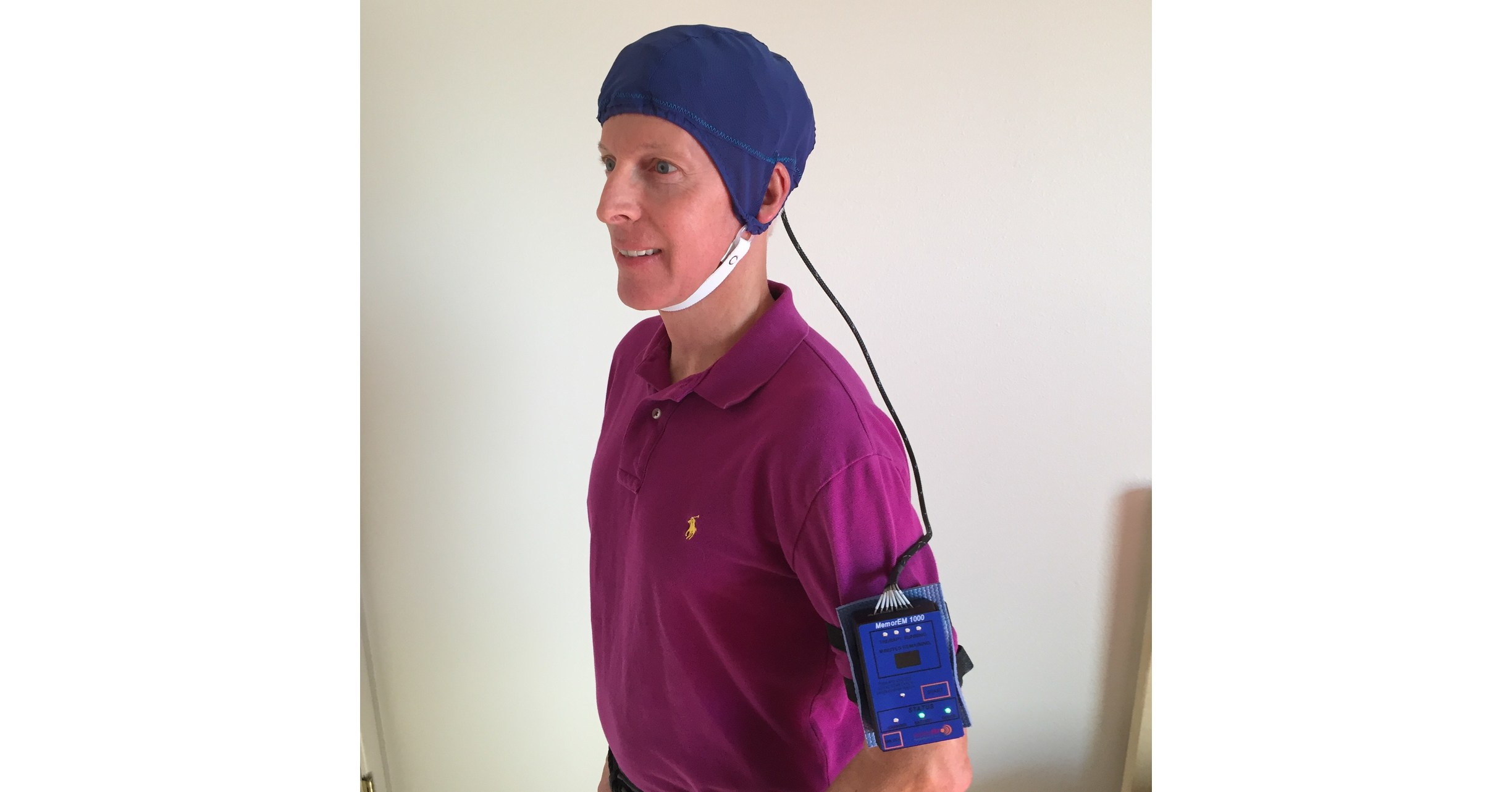 Bioengineered Head Device Stops Alzheimer's Memory Loss for 2.5 Years