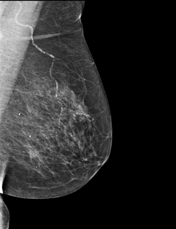 Volpara Health collaborates with Microsoft to accelerate the research ...