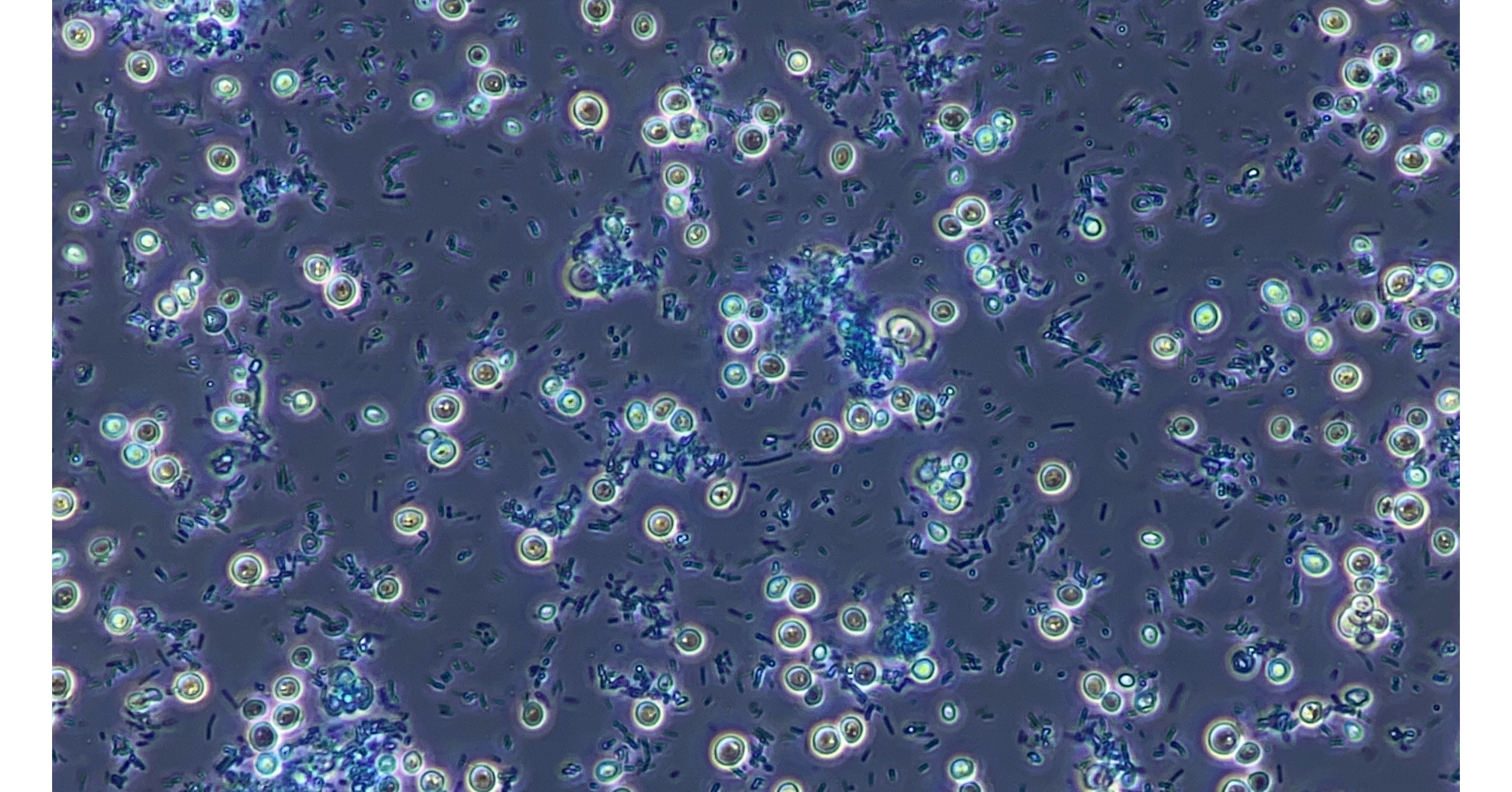 BIOHM Launches World-Class Suite of Services for Microbiome Leaders ...