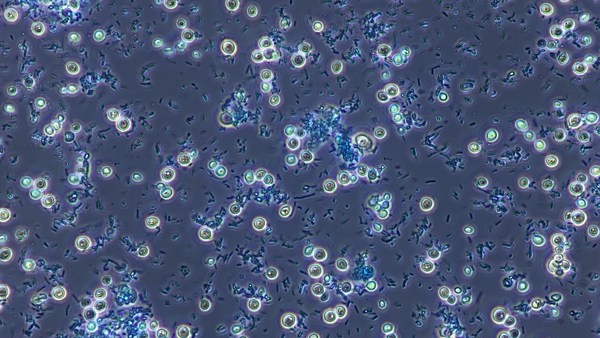 BIOHM Launches World-Class Suite of Services for Microbiome Leaders ...