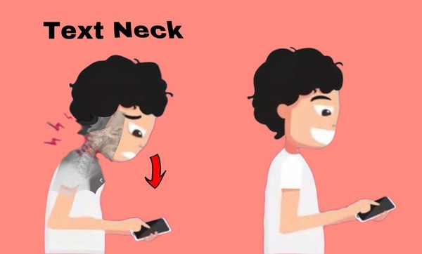 Fix Text Neck with Chiropractic, Study Suggests Chiropractor-Approved ...