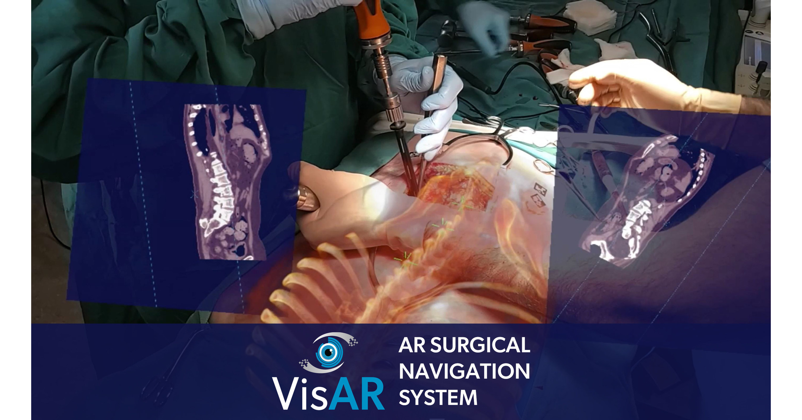 Novarad secures a strategic regional network alliance for its augmented ...