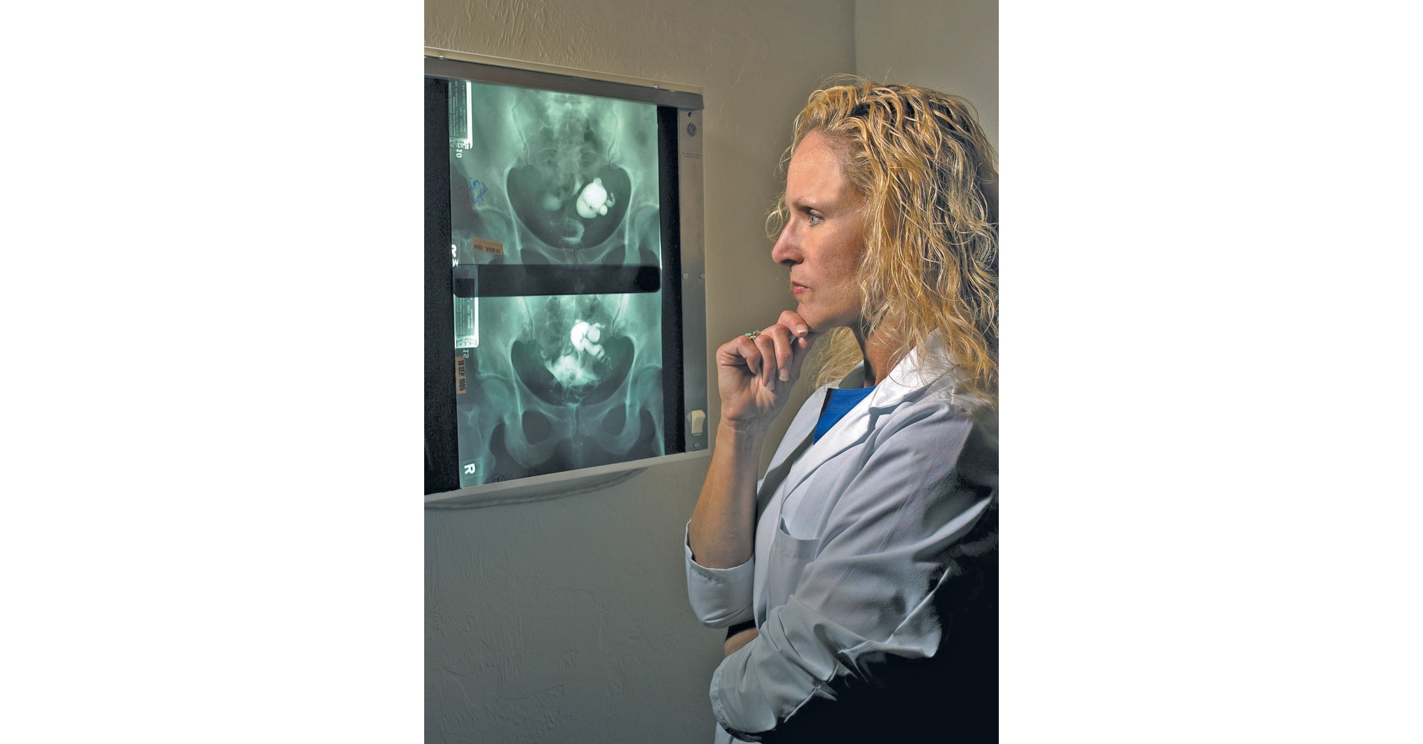 A Husband's Love Creates a New Field of Medicine, Prevents Emergency ...