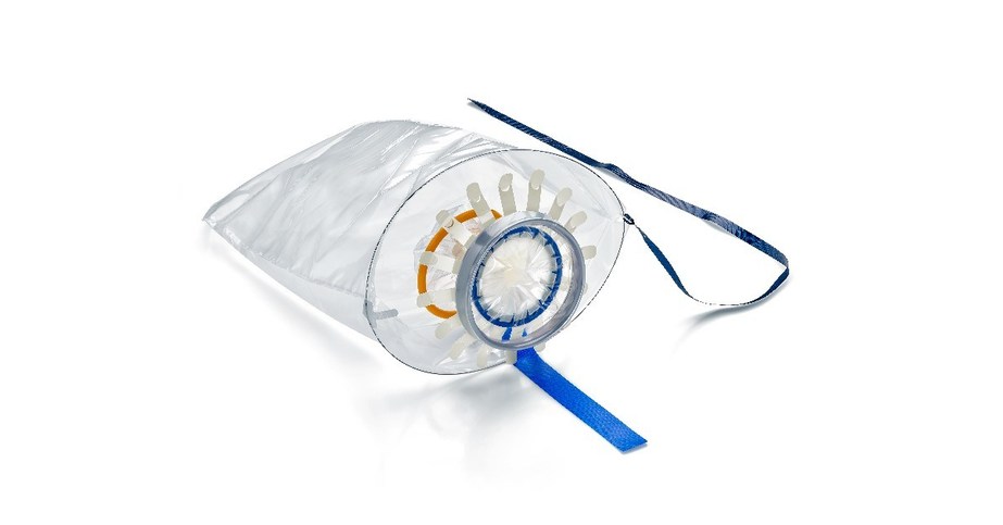 Olympus Launches New Gynecology Contained Extraction System for Manual ...