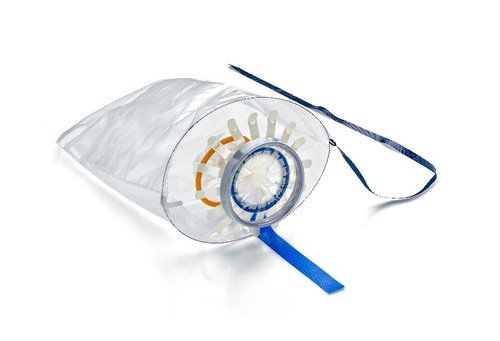 Olympus Launches New Gynecology Contained Extraction System for Manual ...