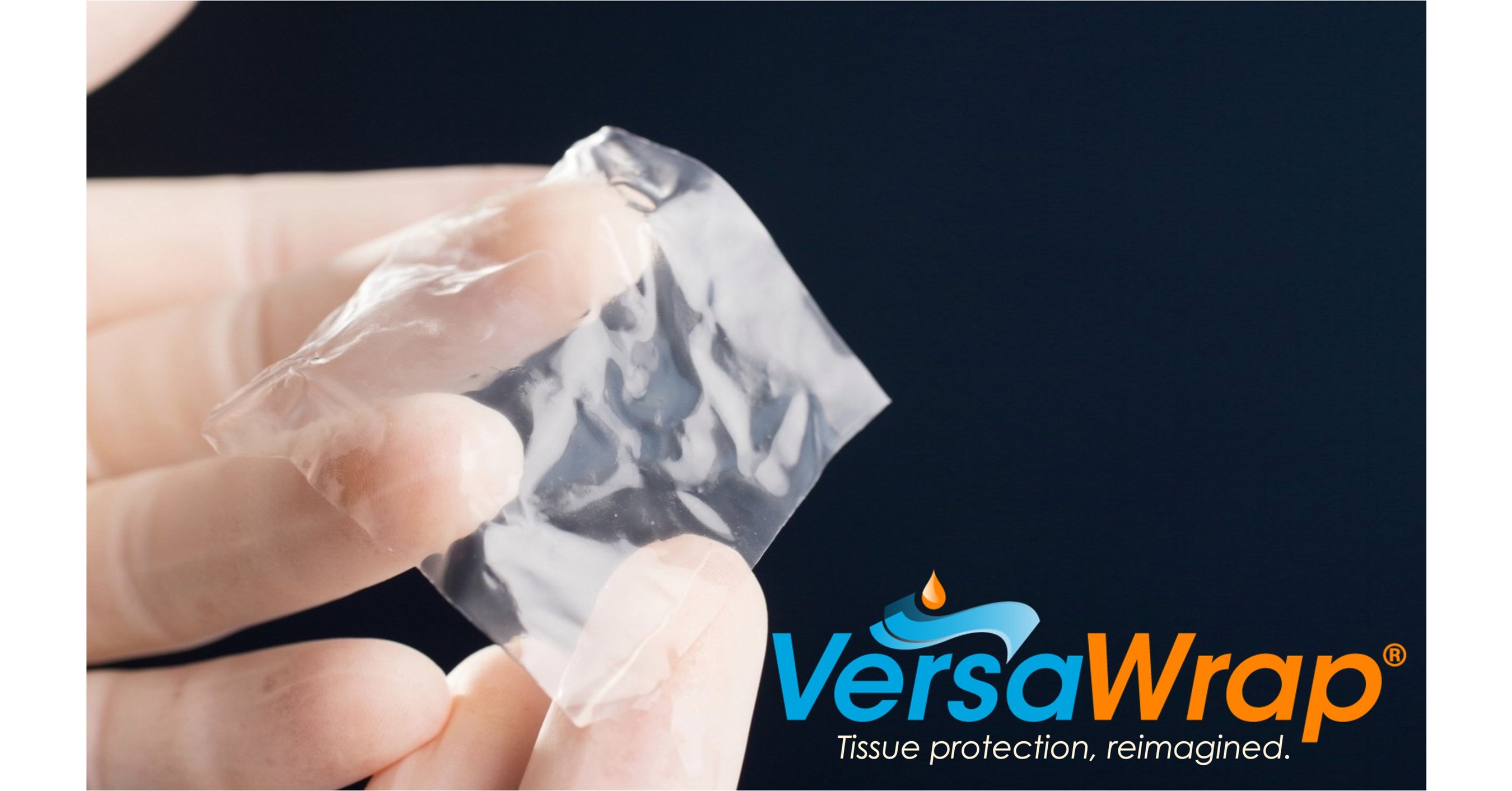 Alafair Enrolls Tenth Patient in Distal Radius Fracture Clinical Study