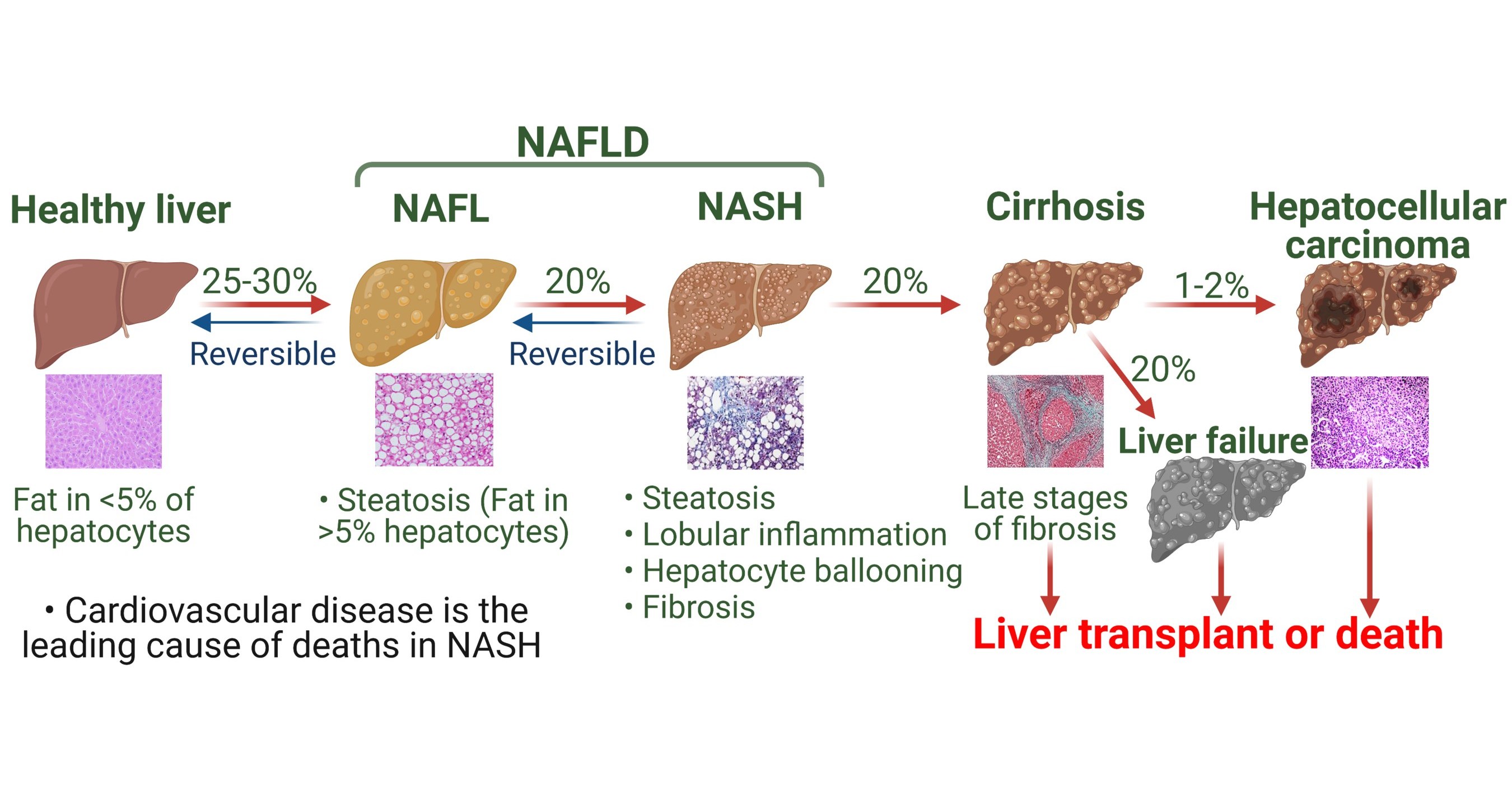 Pathogenesis of Non-alcoholic Fatty Liver Disease: Chinese Medical ...