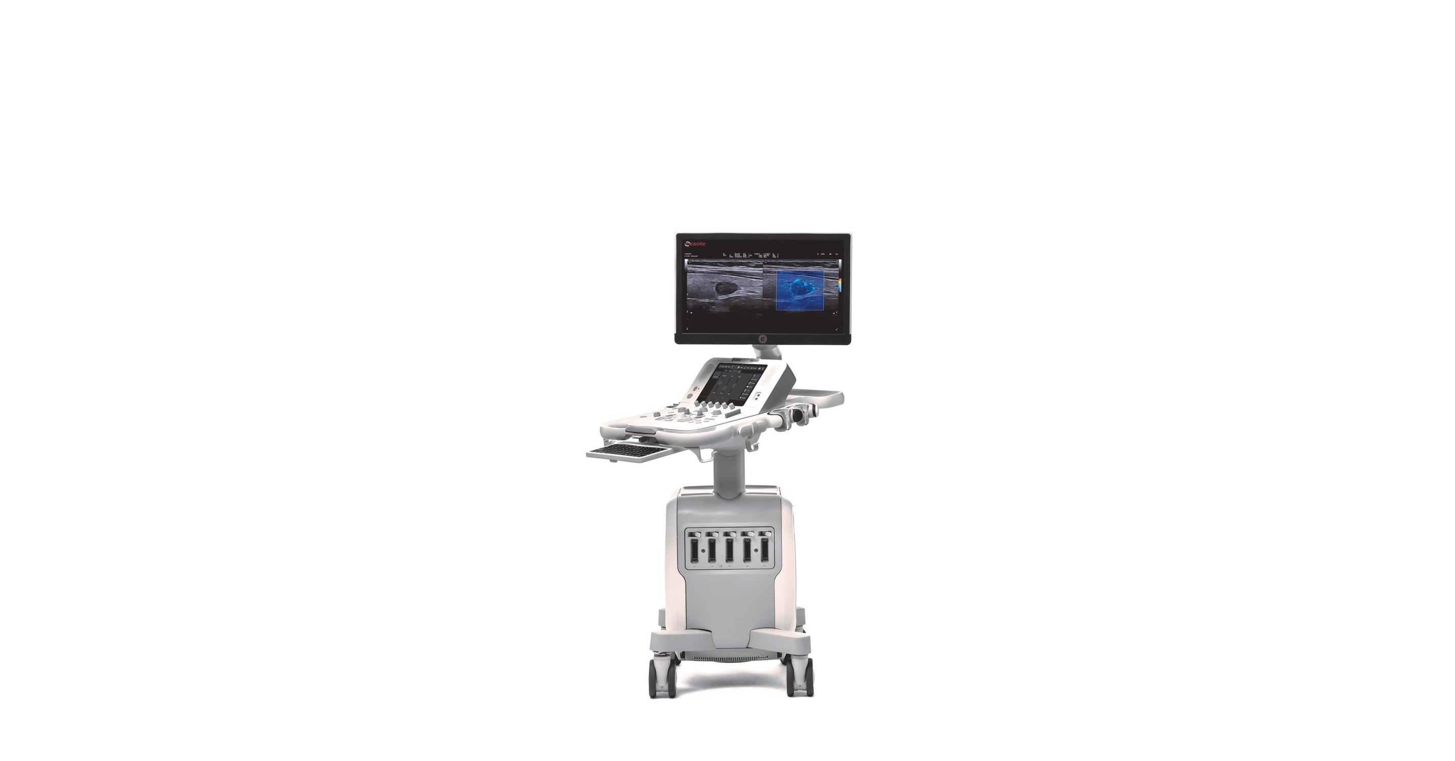 Esaote North America Ultrasound division awarded contract with Vizient ...