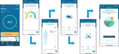 Nevro Announces FDA Approval of HFX iQ™ Spinal Cord Stimulation System ...