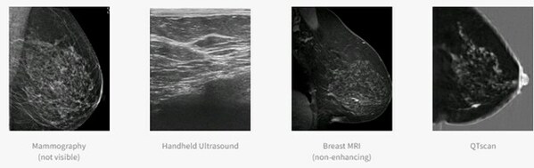 QT Imaging, the University of Illinois, and the Sunnybrook Research ...