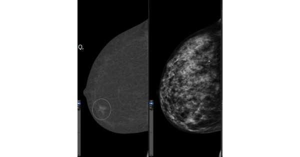 American College of Radiology (ACR) launches Contrast-Enhanced ...