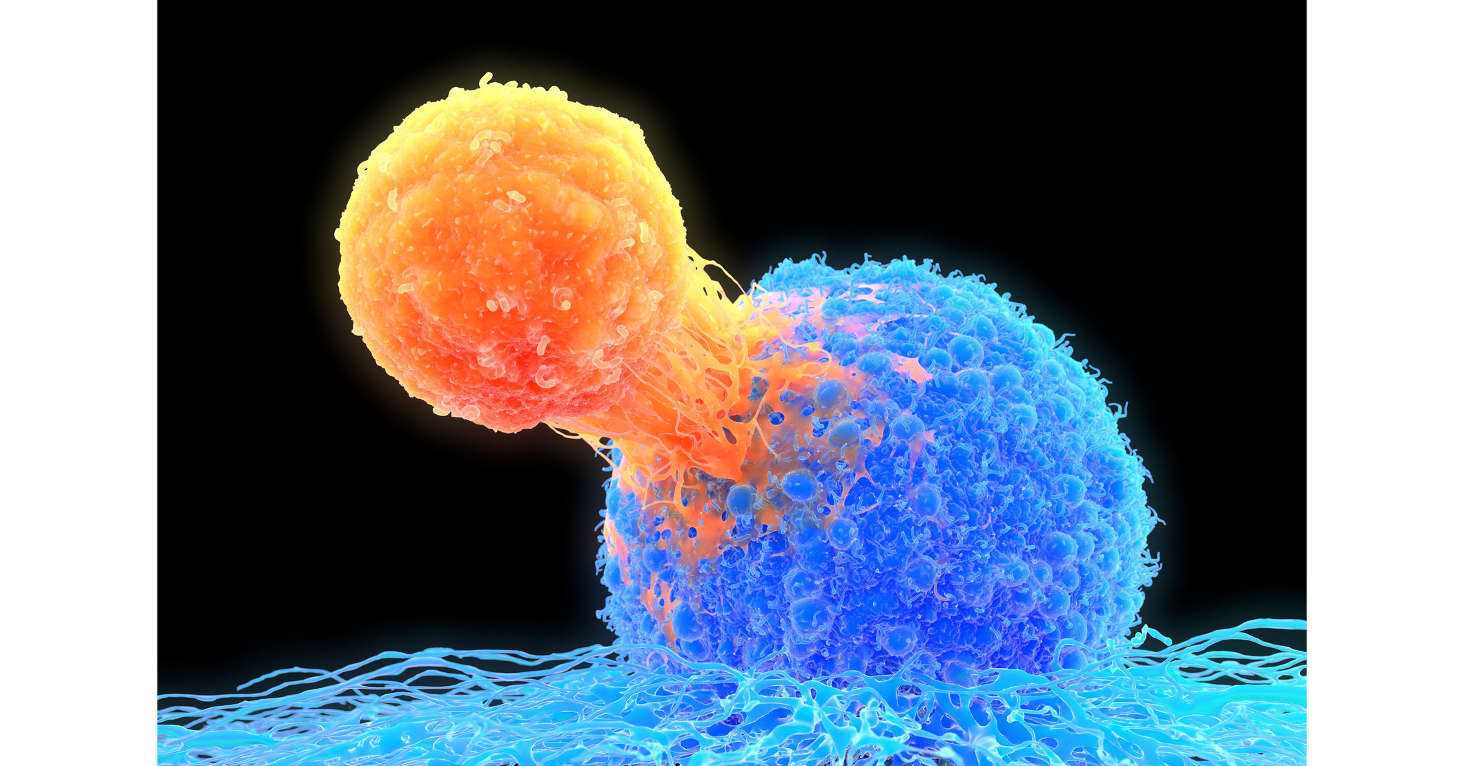 T-cells treated by Turn Biotechnologies show increased cancer-killing ...
