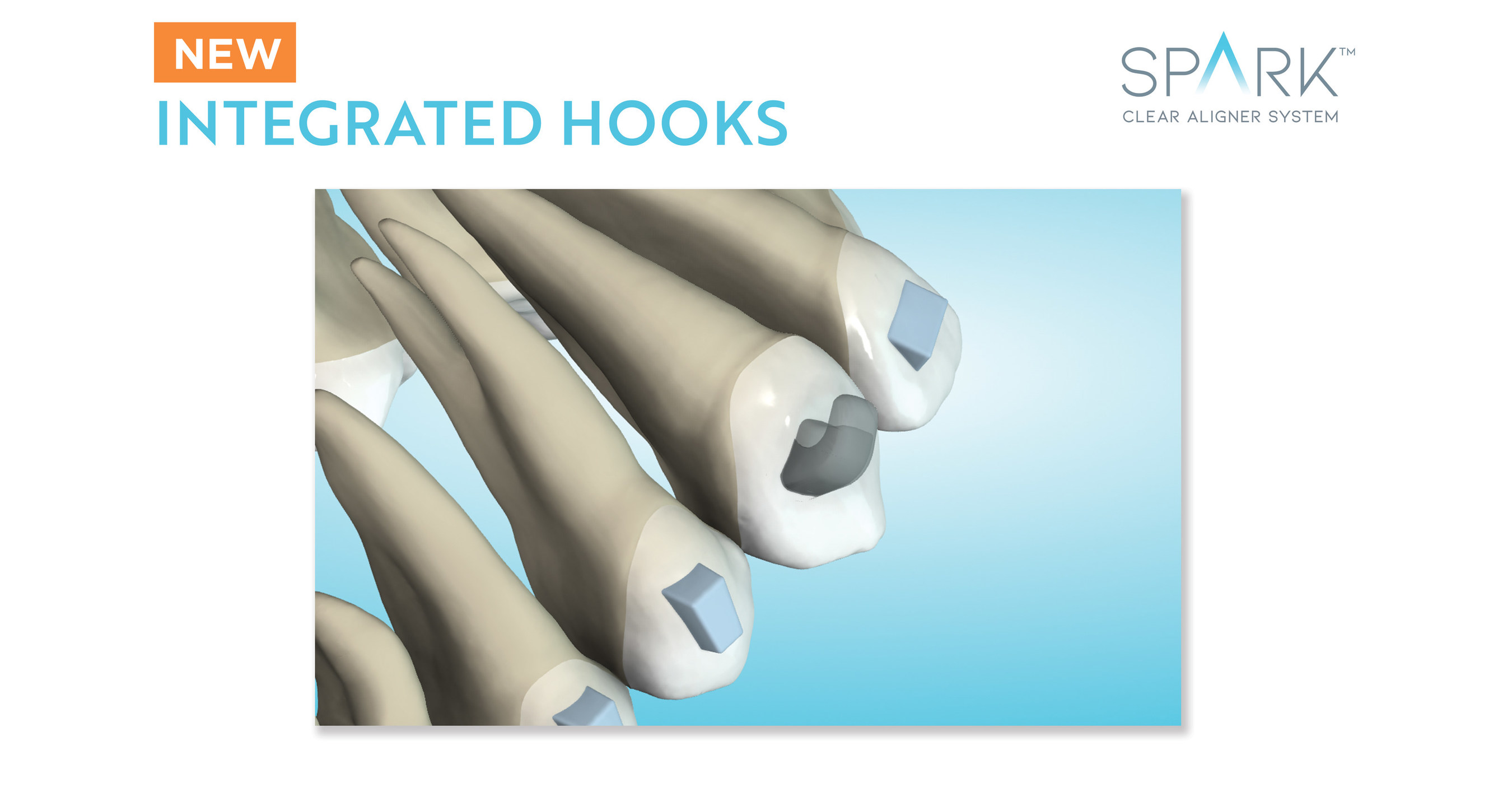 SPARK™ CLEAR ALIGNERS VERSIÓN 13 OFRECE INNOVACIONES ORTODÓNCICAS MUY ESPERADAS CON ...