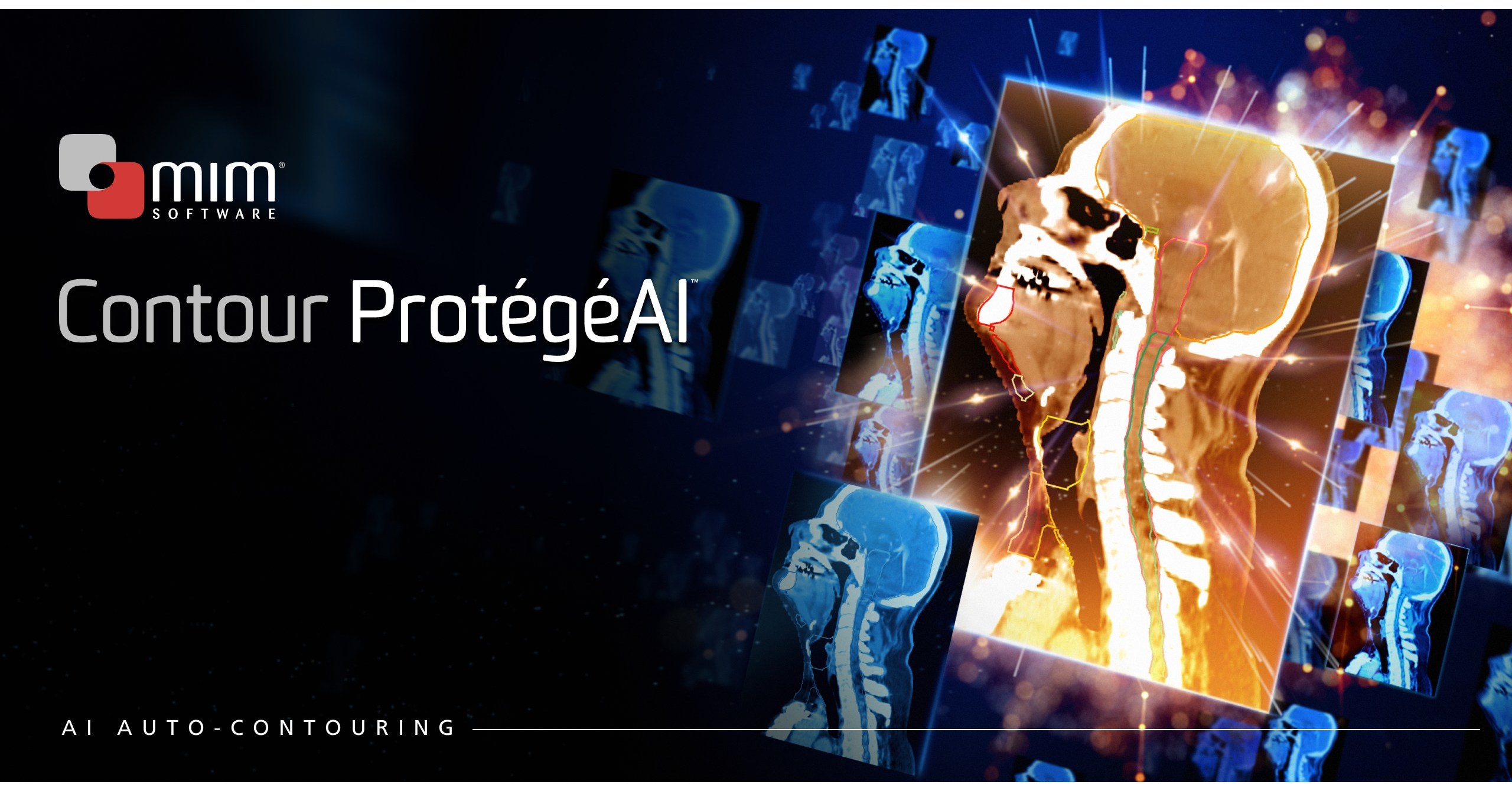 MIM Software Inc. Releases Version 1.1.3 for Contour ProtégéAI Auto ...