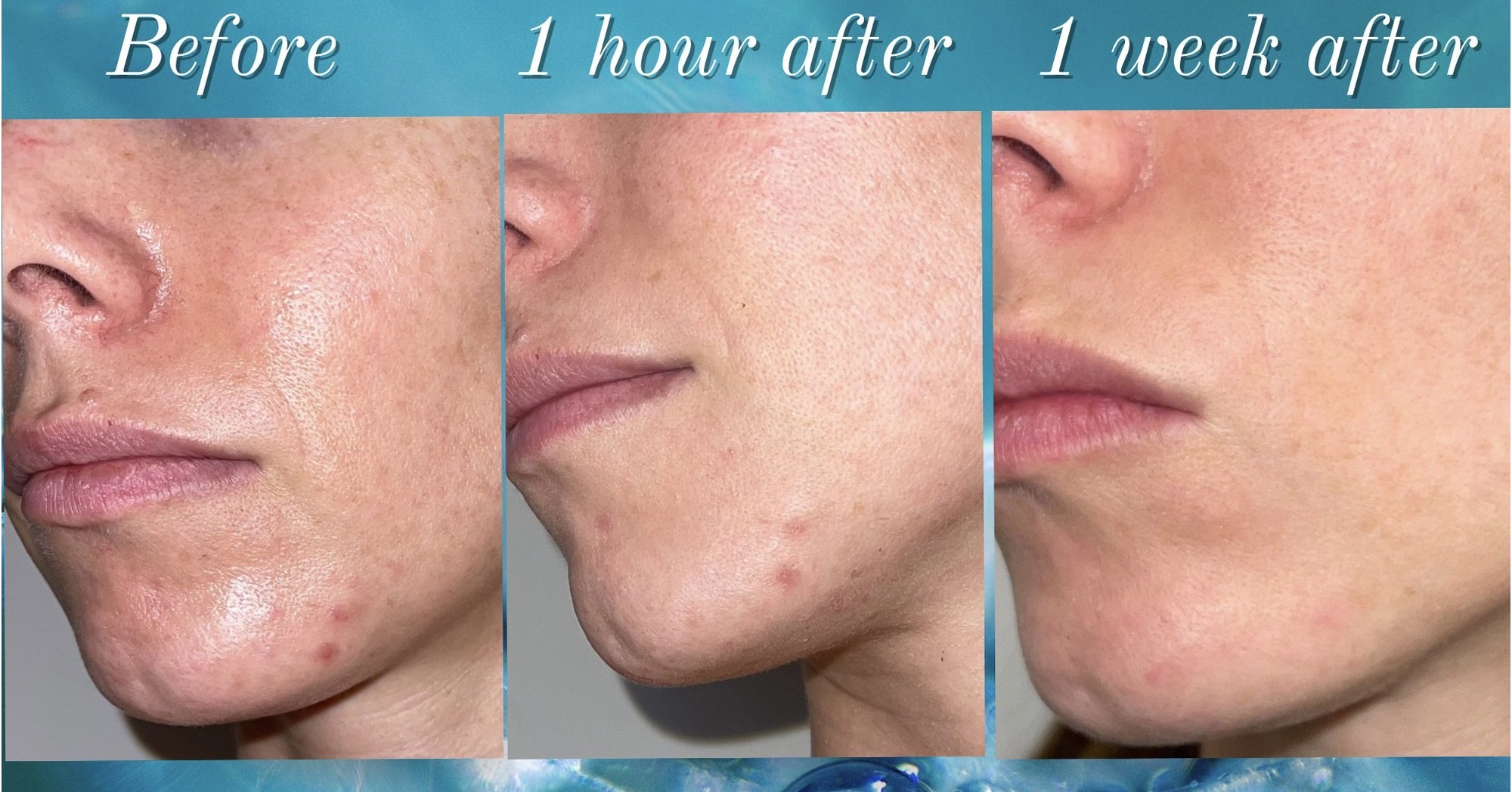 Leading Stem Cell Clinic in the US Develops First Real "Stem Cell Face ...