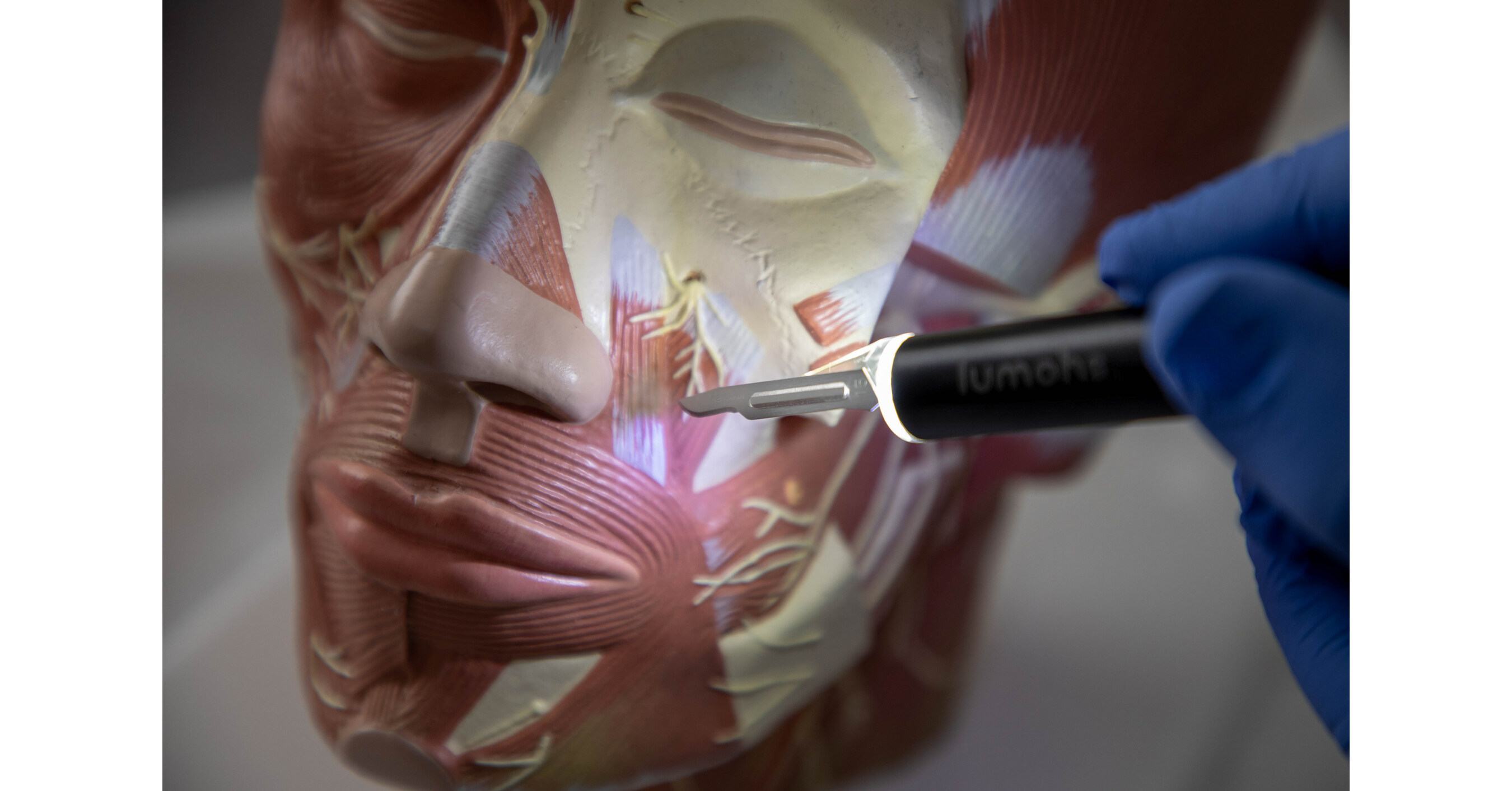 Lumohs Helps Mohs Surgeons, Dermatologists & Plastic Surgeons Avoid ...