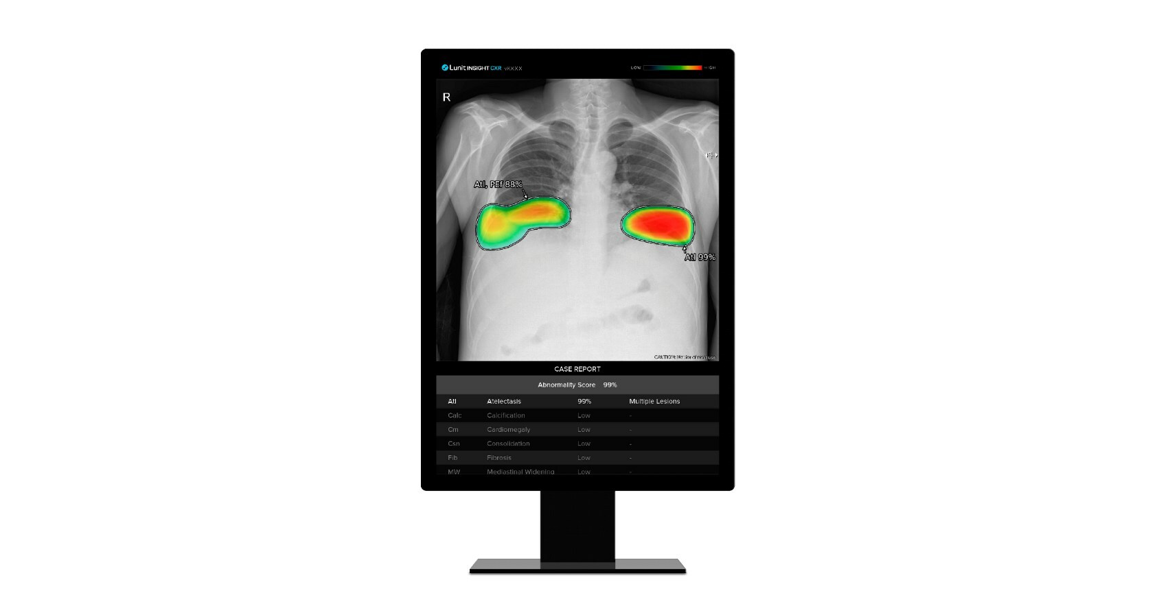 Lunit to Supply AI Solution for Chest X-Ray Analysis to Albert Einstein, Latin America's Largest ...