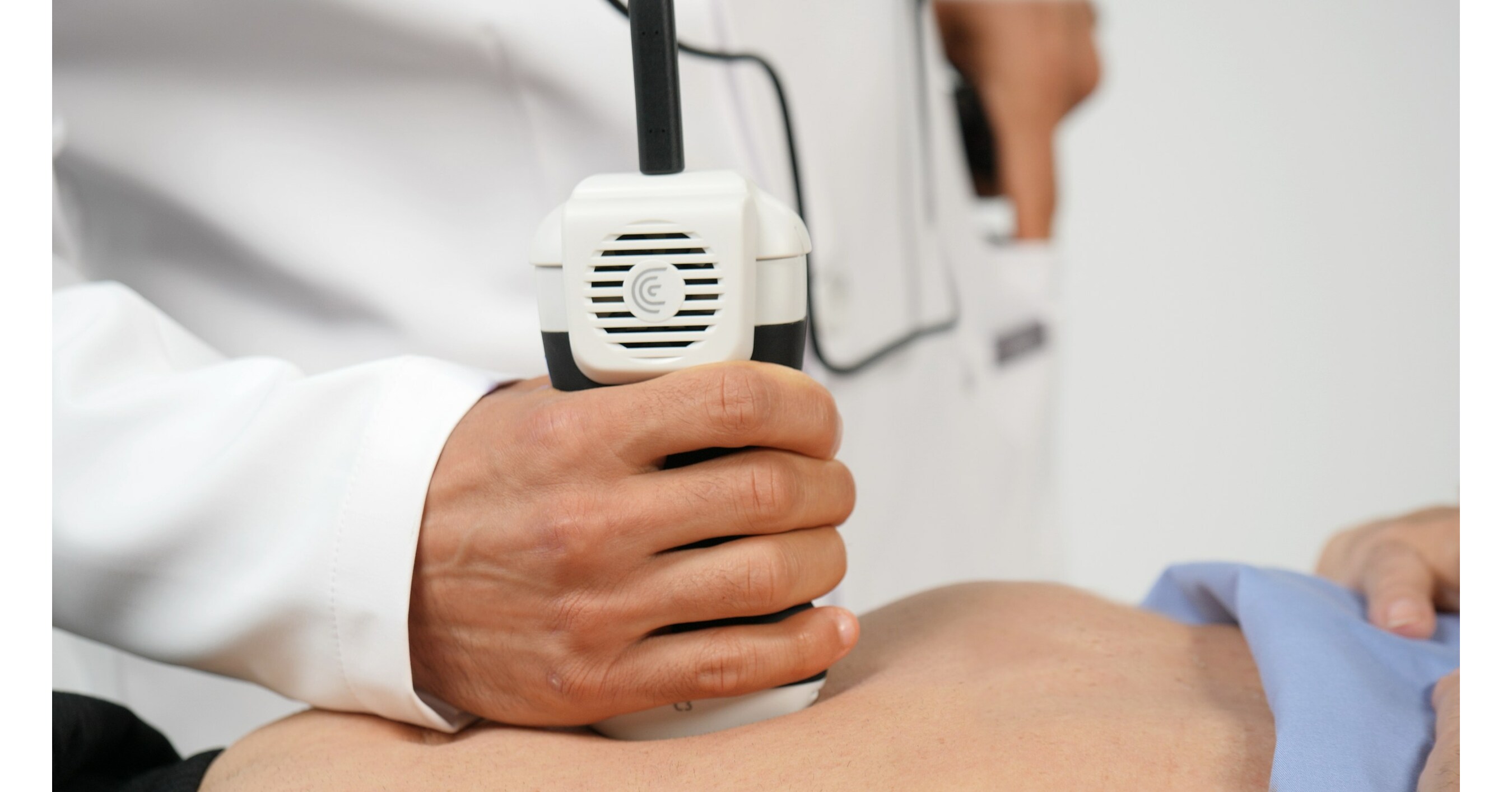 New Clarius Power Fan HD3 Delivers a First for Handheld Ultrasound ...