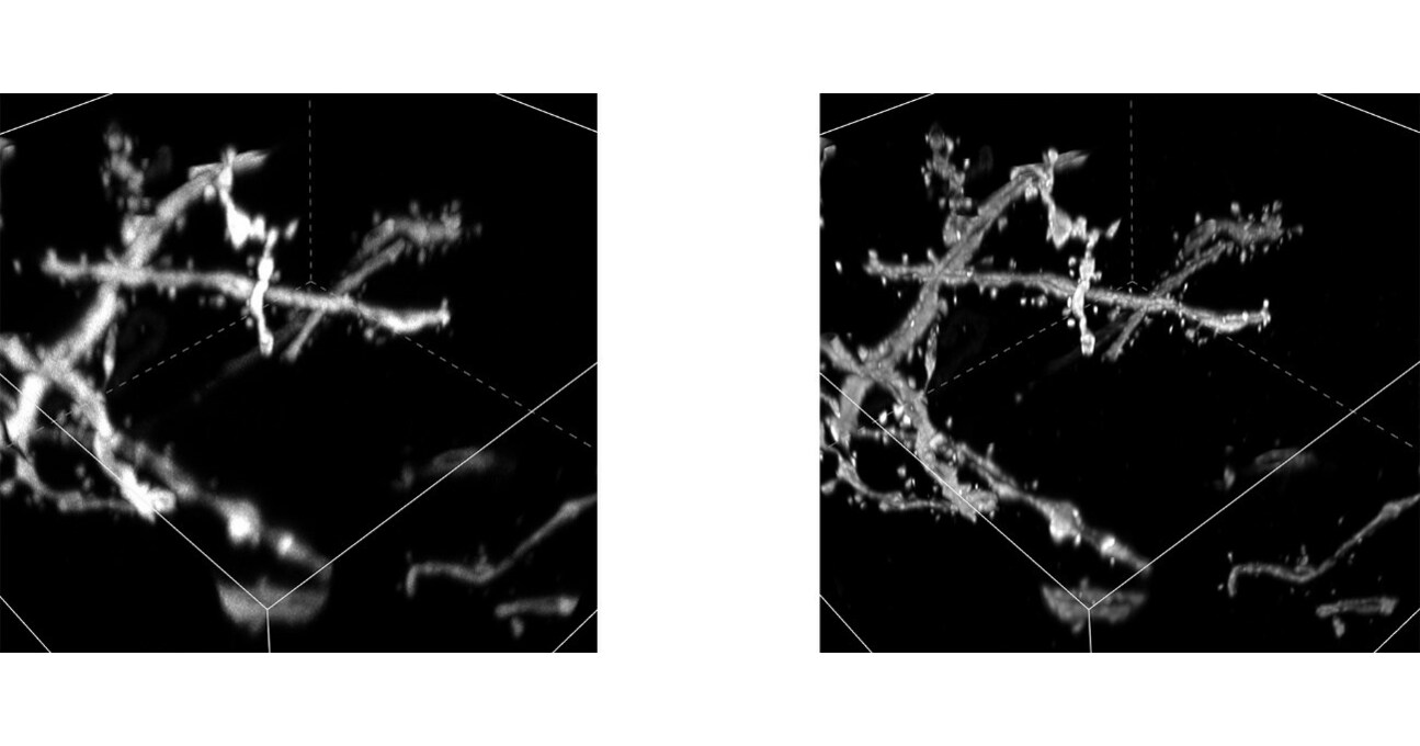 Nikon introduces all new Spatial Array Confocal (NSPARC) Detector for AX