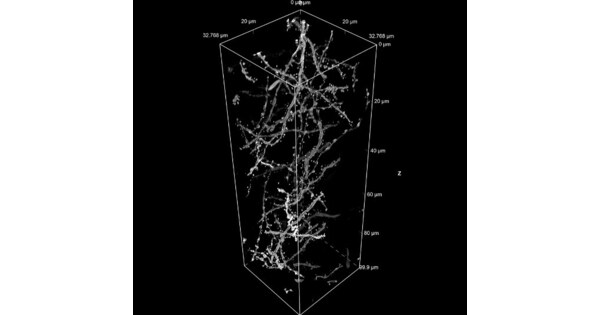 Nikon introduces all new Spatial Array Confocal (NSPARC) Detector for AX