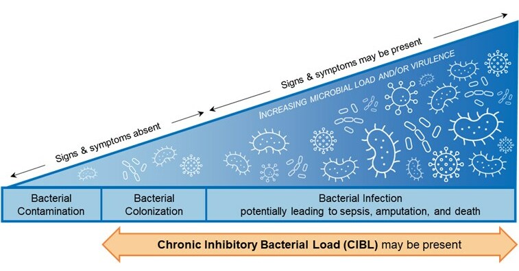 Chronic Inhibitory Bacterial Load (CIBL): New Clinical Terminology for Elevated Levels of ...