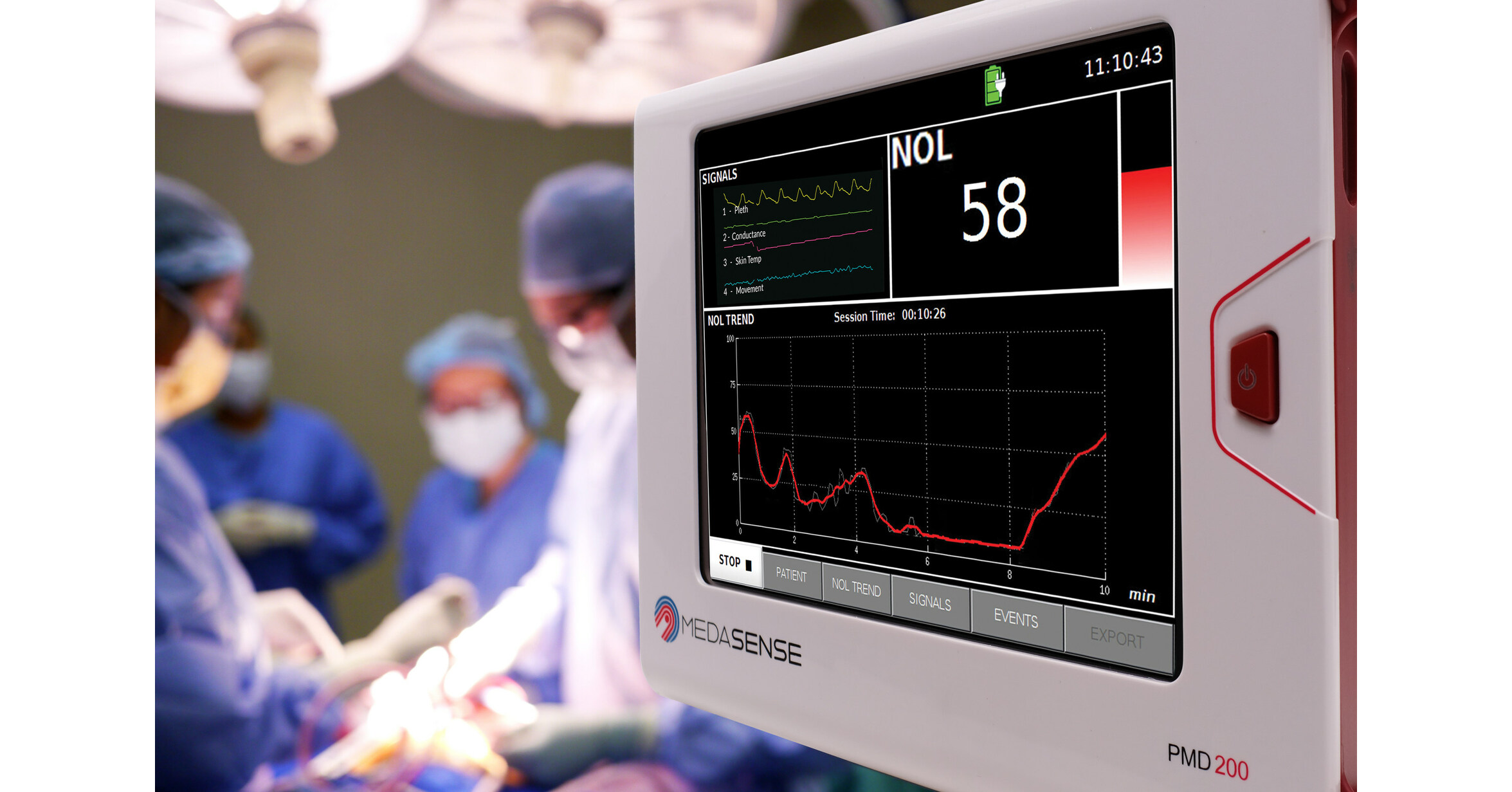 FDA authorizes marketing of Medasense's NOL® (nociception level index ...