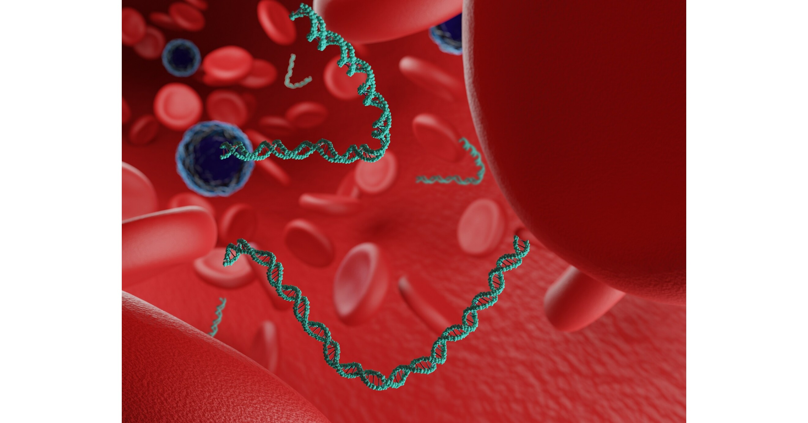 Biotech firm Gene Solutions: A promising picture for multi-cancer early ...