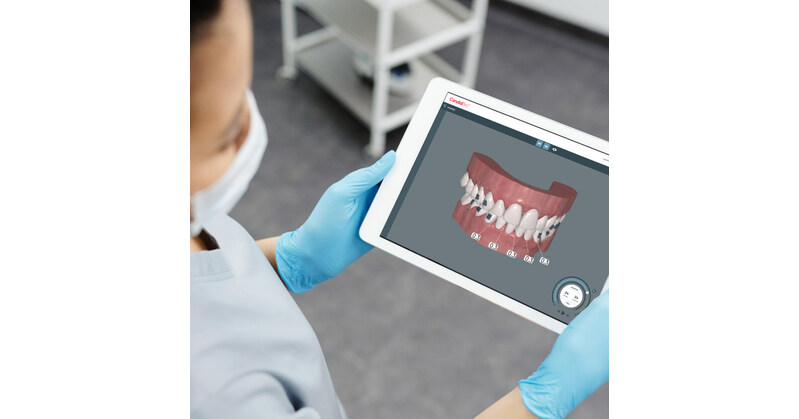 CandidPro™ brings more options and more control to clear aligner doctors
