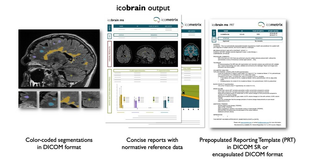 icometrix & Queen Mary University of London receive prestigious AI ...