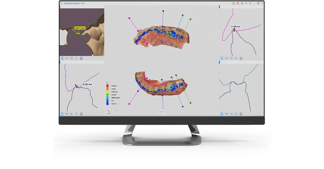 Medit Launches New Occlusion Analyzer App for Quick and Easy Analysis