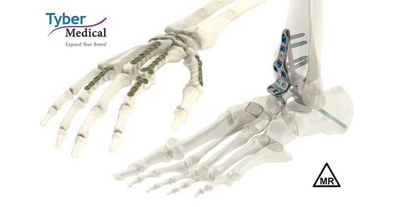 FDA Grants Tyber Medical Clearance to Expand Anatomical Plate Portfolio ...