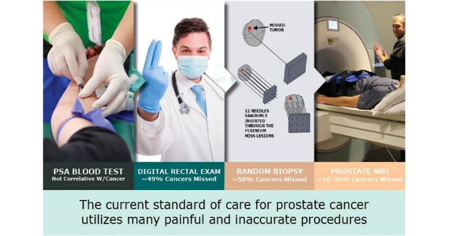 Prostate Cancer Treatment can be safely delayed, and inexpensively and ...