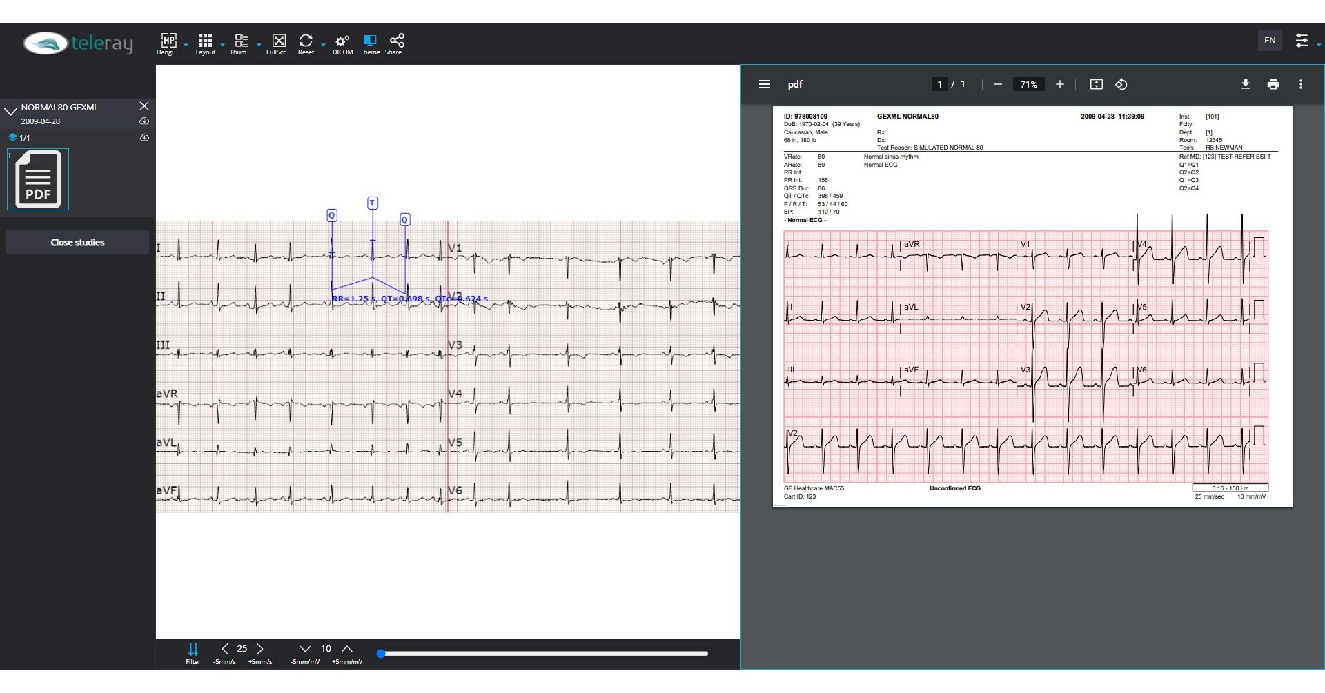 TeleRay Announces ECG Results into DICOM and EMR