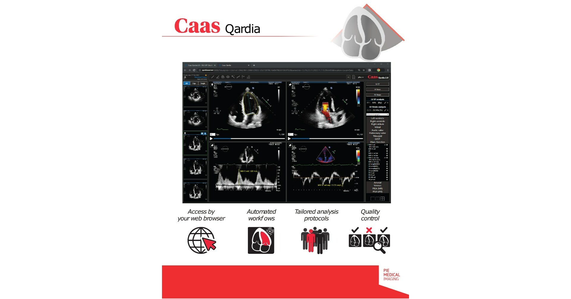 The innovative echocardiography software platform "CAAS Qardia" by Pie ...