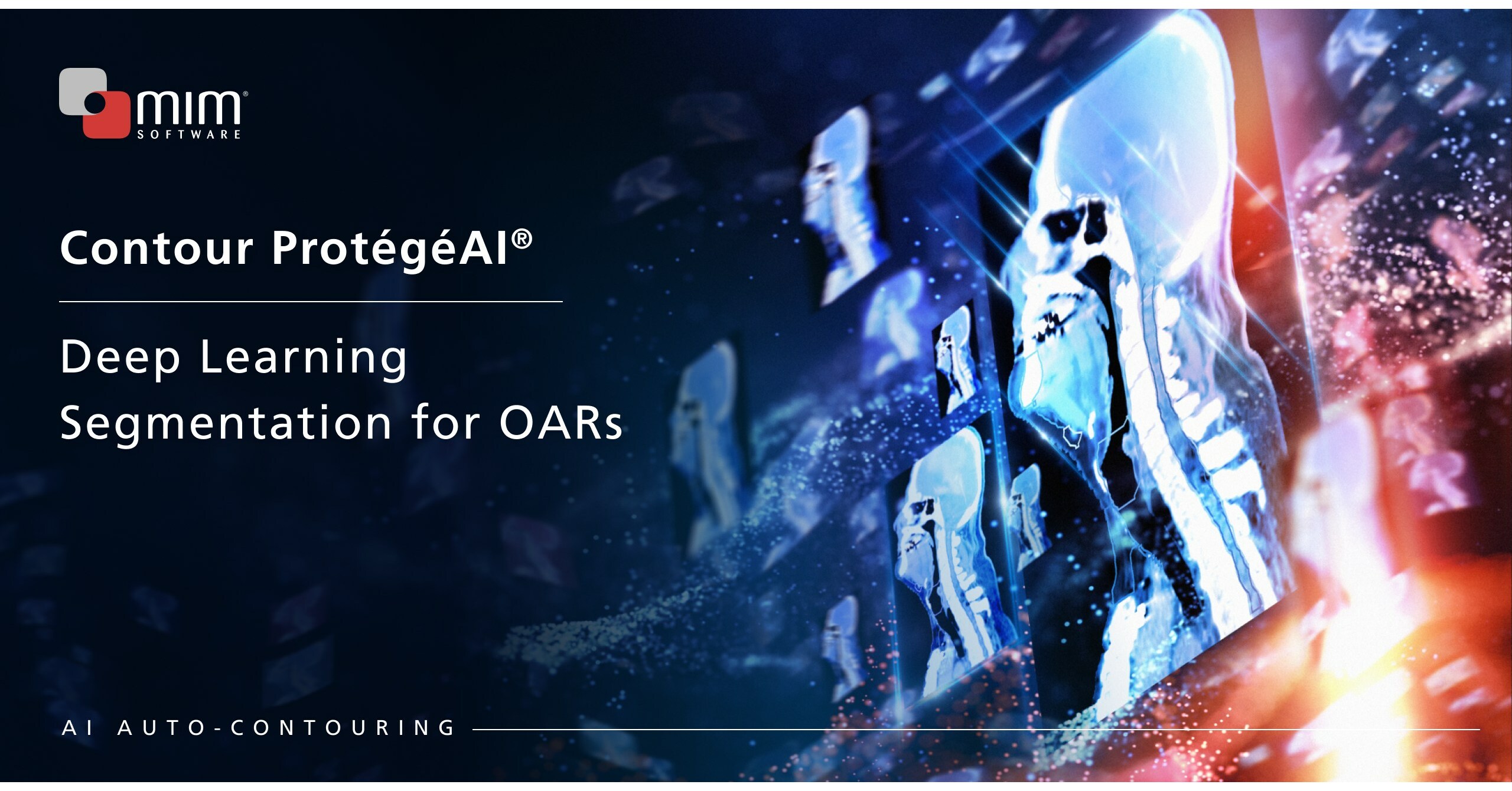 MIM Software Inc. Announces FDA Clearance of Contour ProtégéAI® 4.0 Models