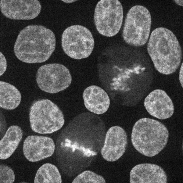 From Seattle to Space: Science that Began at the Allen Institute Blasts ...