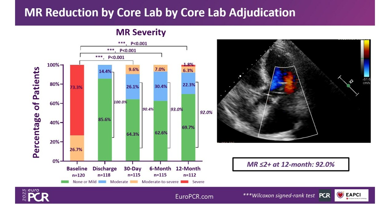 Novel Transcatheter Valve Repair Device: DRAGONFLY-DMR 12-Month Trial ...