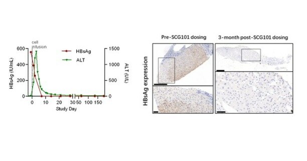 ISCT 2023: Late-breaking SCG101 Data Show 100% HBsAg+ Hepatocyte ...