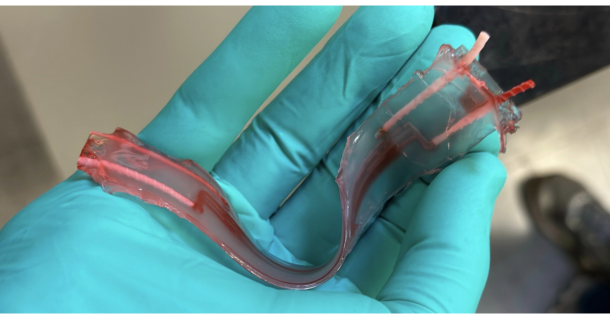 IVIVA Medical Wins KidneyX Prize for Advanced Organ Therapeutics to ...