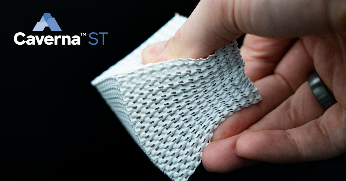 3D PRINTING MATERIAL ENABLES NEW WAY TO MAKE SOFT-TOUCH PARTS