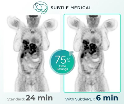 Subtle Medical Showcasing AI-Powered SubtlePET Software for Faster PET ...