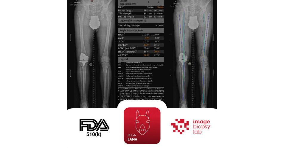 FDA clears ImageBiopsy Labs' latest AI-powered Software for a ...