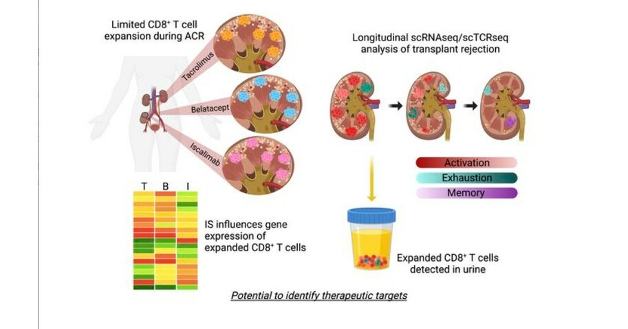 Research Reveals Novel Insights into Transplant Rejection and New Drug ...