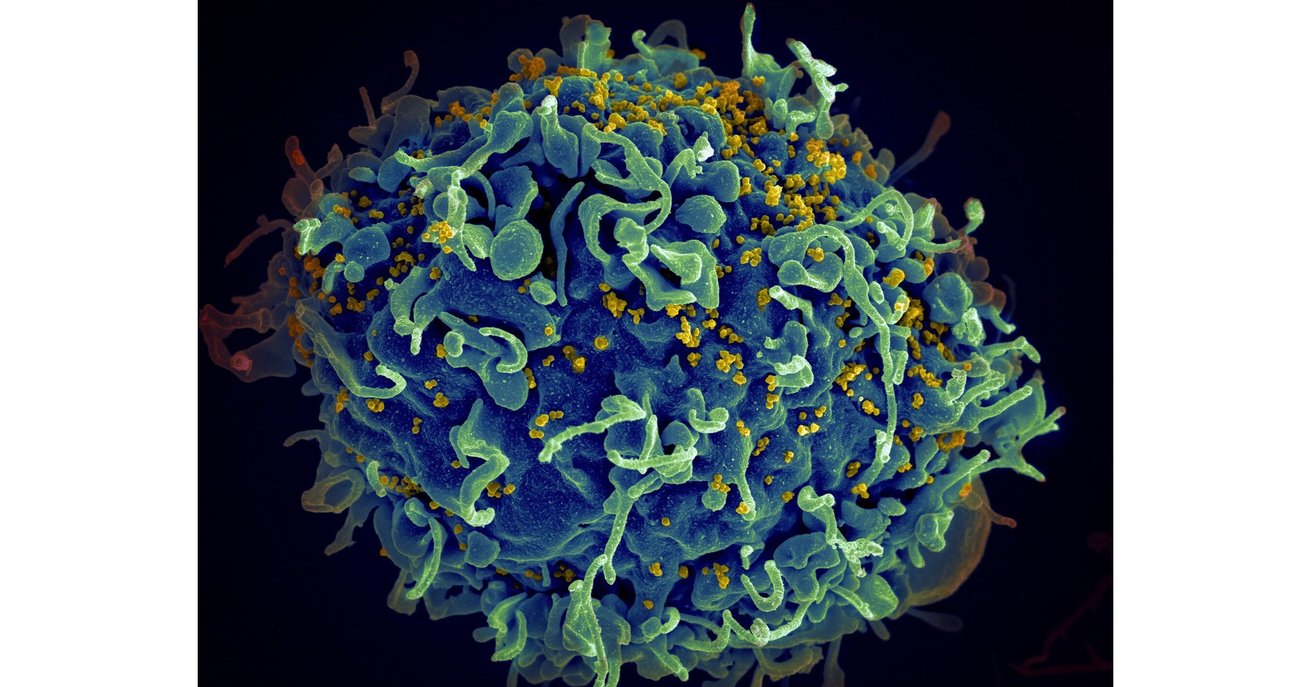 Researchers Find New Pathway for HIV Invasion of Cell Nucleus