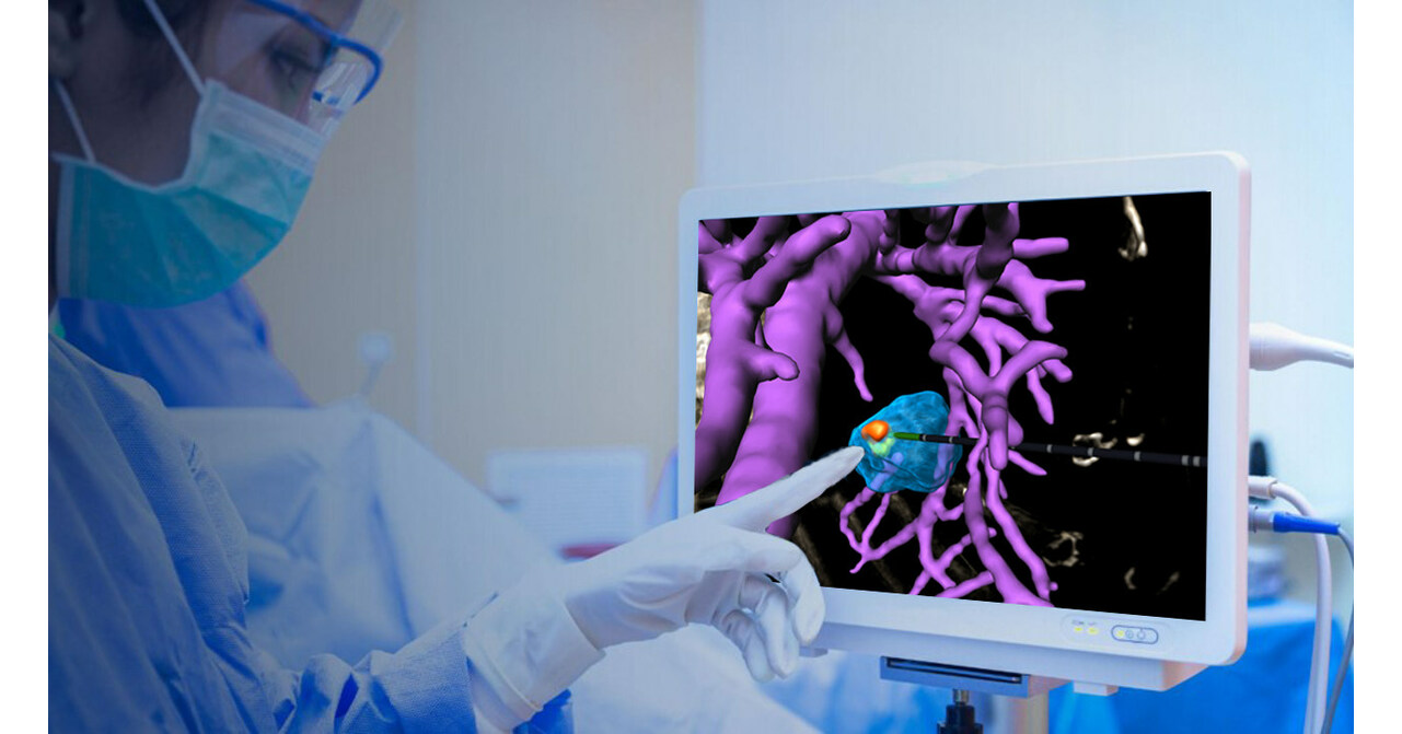 Techsomed Announces FDA Clearance for Ablation Treatment Planning and ...