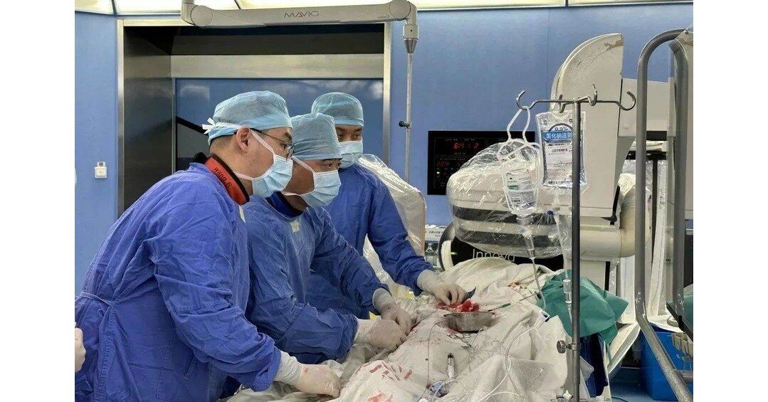 First Patient with NyokAssist™ Interventional Ventricular Assist Device ...