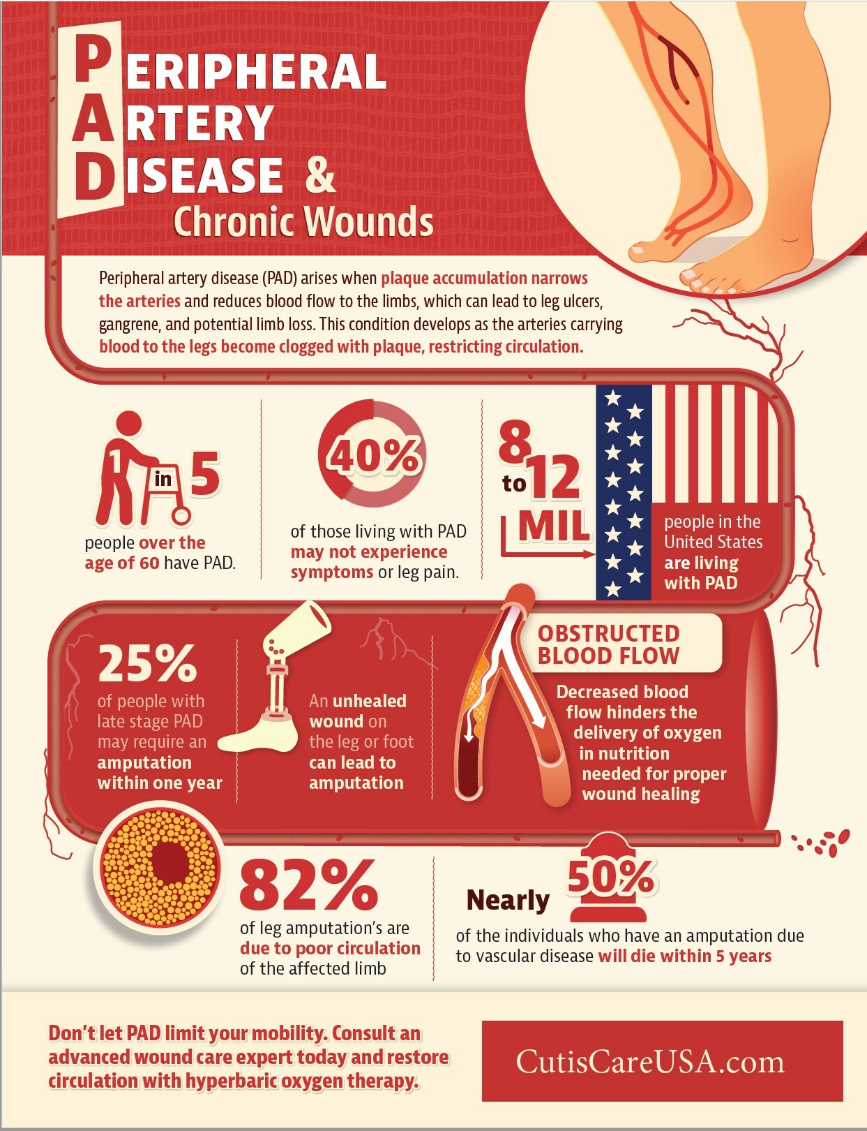 CūtisCare Shines a Spotlight on PAD Awareness Month: Empowering ...