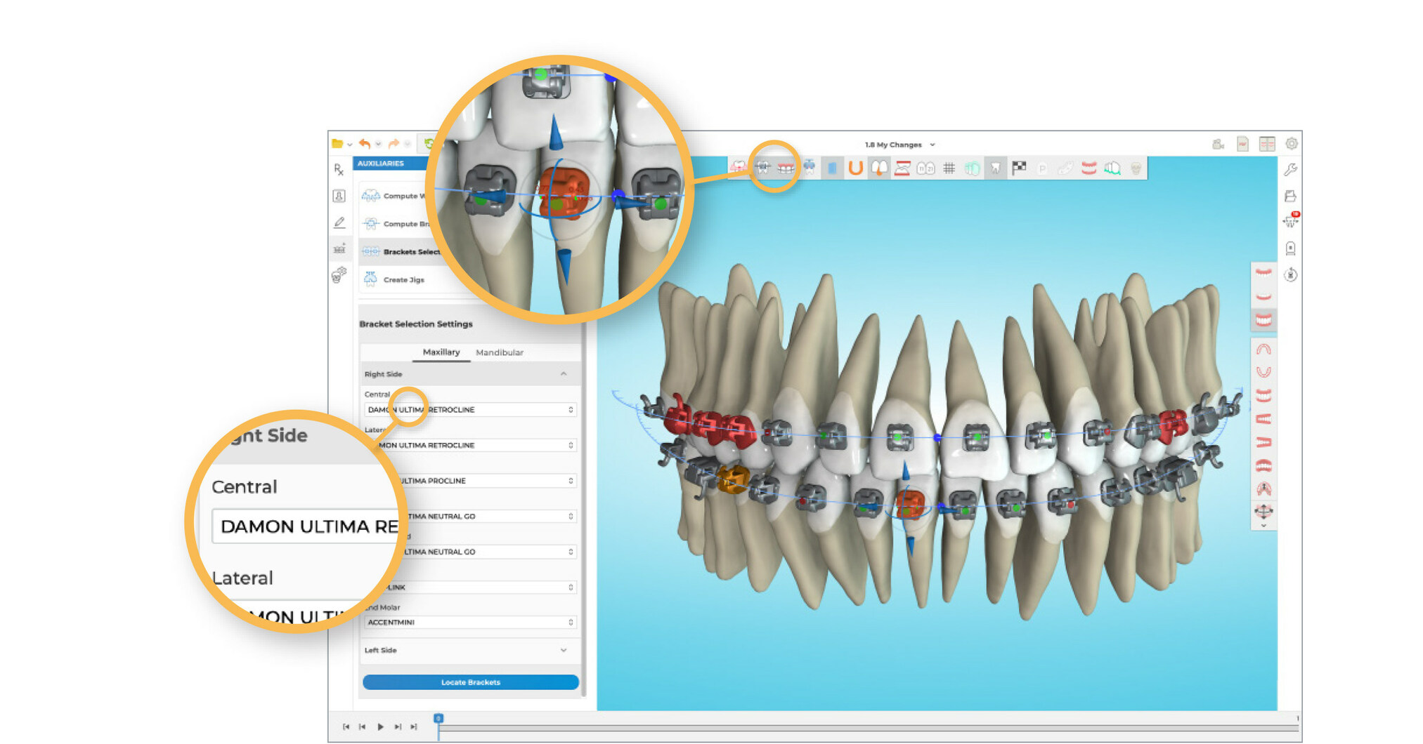 Ormco Announces The Launch Of Its Latest Innovation Ormco™ Digital Bonding Powered By Spark