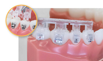 Ormco Announces the Launch of its Latest Innovation - Ormco™ Digital ...