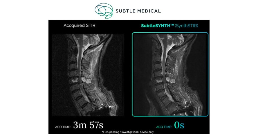 Subtle Medical Awarded $2.3M SBIR Grant to Expand Innovation in AI ...